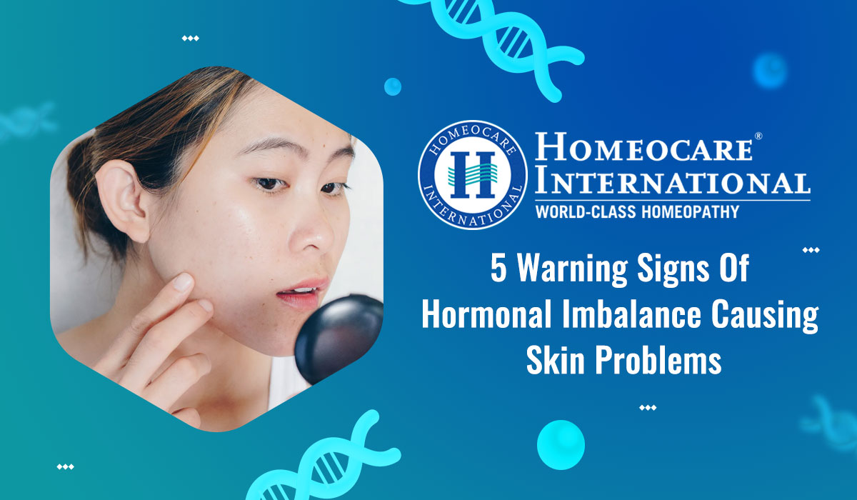 Homeopathy Treatment for Hormonal Imbalance